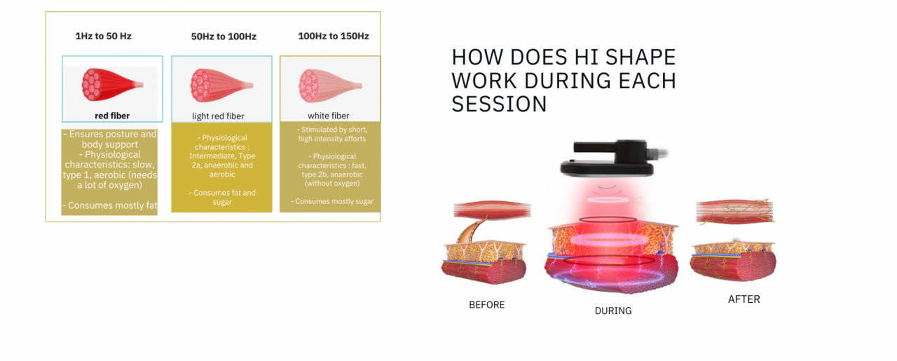 Emsculpt body Perth |Arm sculpting |Thighs sculpting Perth - Hi Shape Max