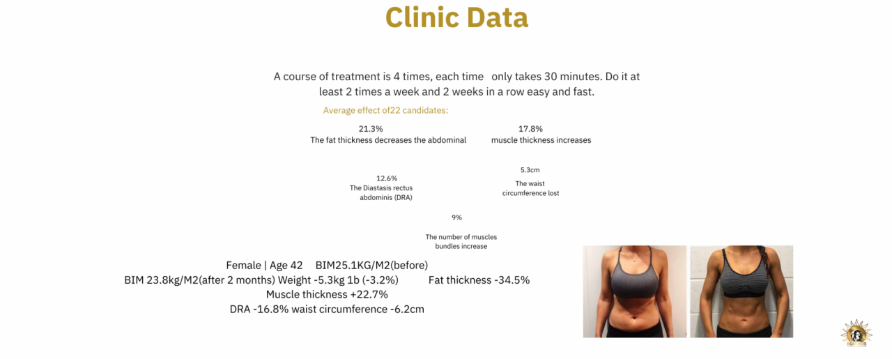 Emsculpt body Perth |Arm sculpting |Thighs sculpting Perth - Hi Shape Max